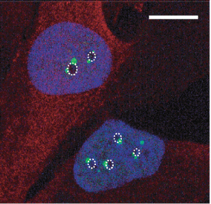 What regulates ribosomal DNA damage repair? | Oeffinger Lab